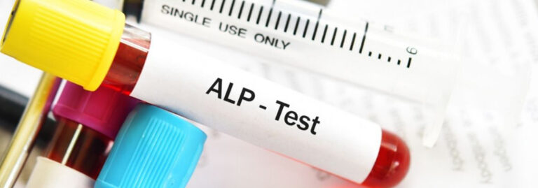 Alkaline Phosphatase ALP – Annai Diagnostics