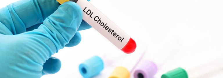 LDL Cholesterol Direct – Annai Diagnostics